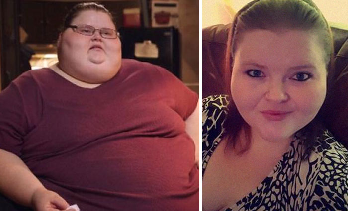 24 Before and After Photos from 'My 600 lb.-Life' that Will Make You ...